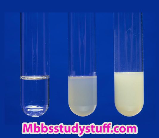 Fat determination in milk - Its principle and procedure - Medical Study ...