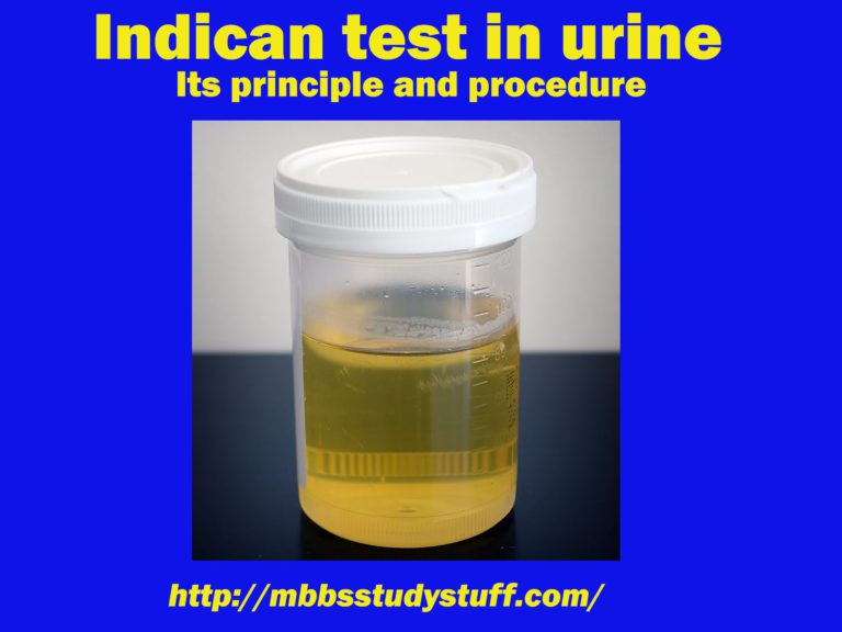 Indican test in urine - Its principle, reagents and procedure - Medical ...