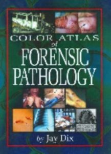 Color Atlas of Forensic Pathology PDF Free Download - Medical Study Zone