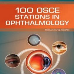100 OSCE Stations in Ophthalmology By Mirza Shafiq Ali Baig PDF Free ...