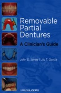 Removable Partial Dentures: A Clinician's Guide PDF Free Download ...