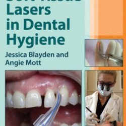Soft Tissue Lasers In Dental Hygiene Pdf Free Download Archives