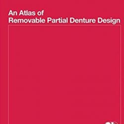 Atlas of Removable Partial Denture Design PDF Free Download Archives ...
