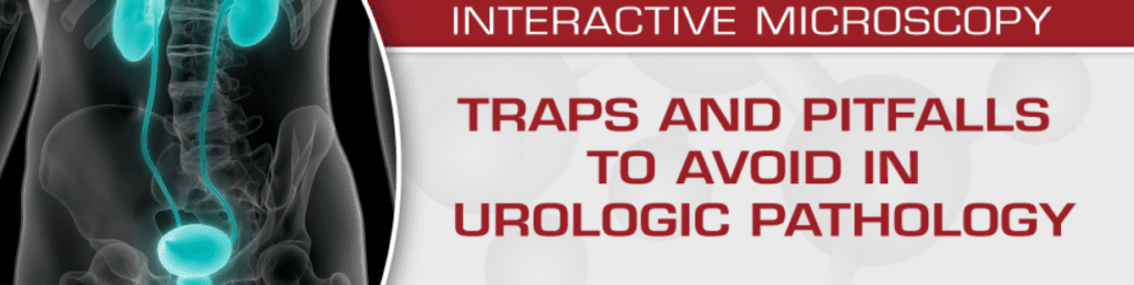 Traps And Pitfalls To Avoid In Urologic Pathology 2019 Videos and PDF Free Download - Medical ...