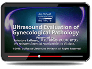 Gulfcoast: Ultrasound Evaluation of Gynecological Pathology Videos Free ...