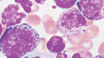 Masters of Pathology: Hematopathology 2021 Videos Free Download ...