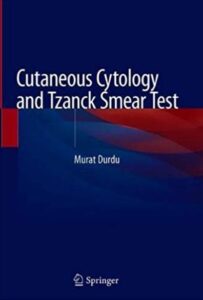 Cutaneous Cytology and Tzanck Smear Test PDF Free Download - Medical ...