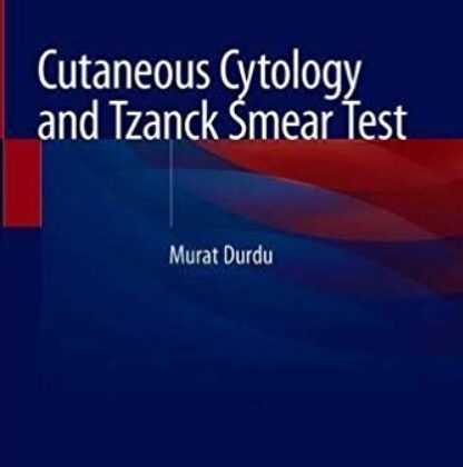 Cutaneous Cytology and Tzanck Smear Test PDF Free Download Archives ...
