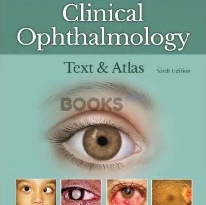 OPHTHALMOLOGY Archives - Medical Study Zone