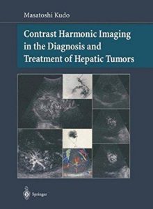 Contrast Harmonic Imaging in the Diagnosis and Treatment of Hepatic ...