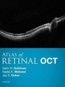 Atlas of Retinal Oct PDF Free Download - Medical Study Zone
