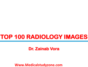 Top 100 Radiology Images By Dr Zainab Vora PDF Free Download - Medical ...